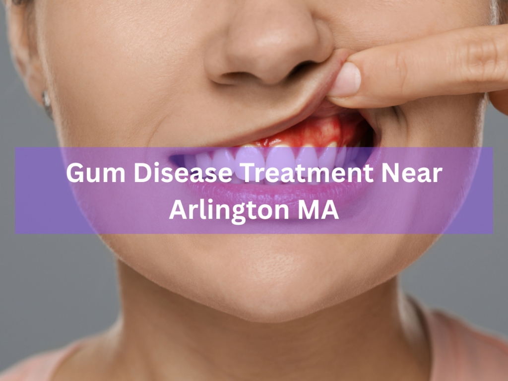 Gum Disease Treatment Near Arlington MA – Arlington MA Dentist ...