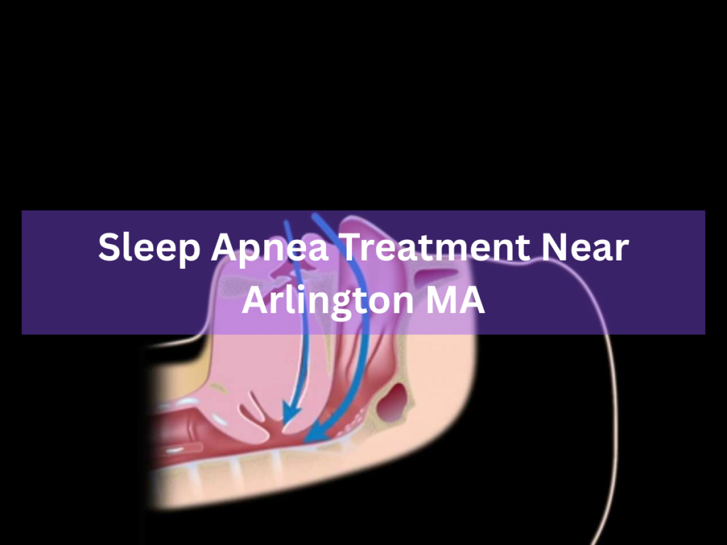 Sleep Apnea Treatment Near Arlington MA – Arlington MA Dentist ...